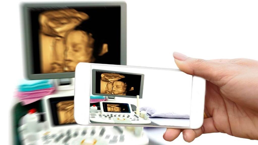 What To Know About The 3D Ultrasound Peanut what-to-know-about-the-3d-ultrasound-peanut