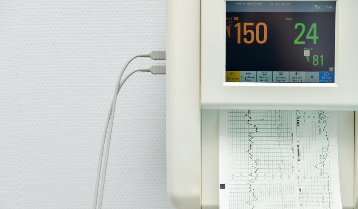 How to Read and Understand Contractions on a Monitor | Peanut